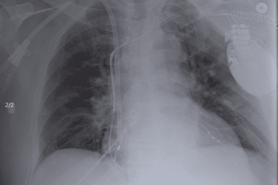 Hearing-aid specialist whose heart stopped praises 'guardian angels ...